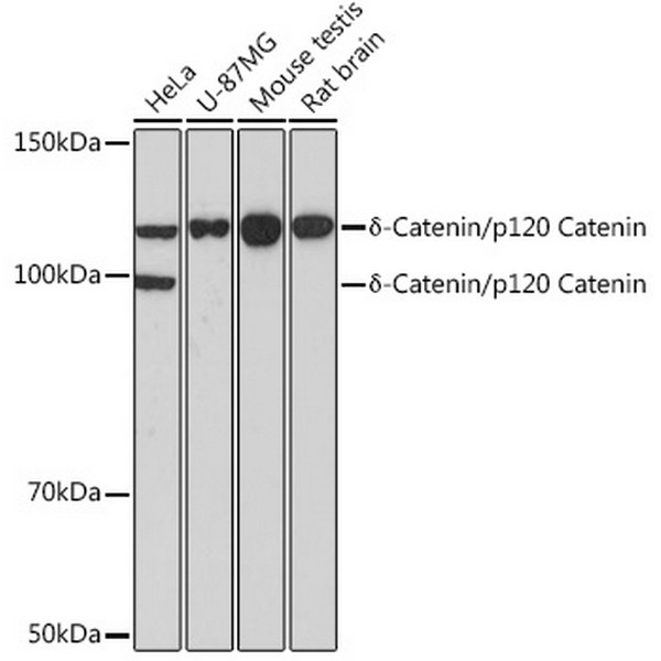 δ-Catenin/p120 Catenin Rabbit mAb (A11399) | Abclonal | Ushelf