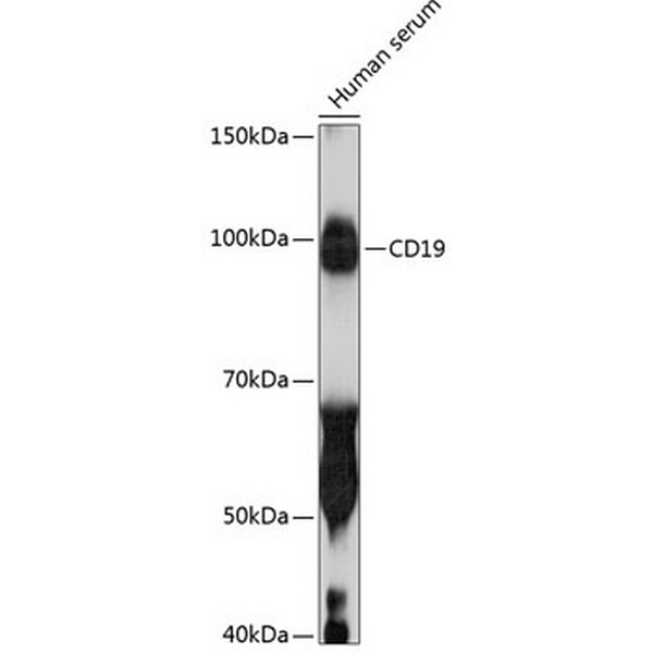 CD19 Rabbit mAb (A19013) | Abclonal | Ushelf