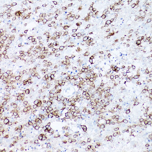 CD19 Rabbit mAb (A19013) | Abclonal | Ushelf