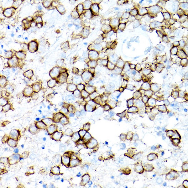 CD19 Rabbit mAb (A19013) | Abclonal | Ushelf