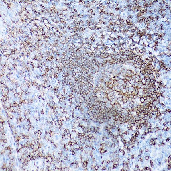 CD19 Rabbit mAb (A19013) | Abclonal | Ushelf
