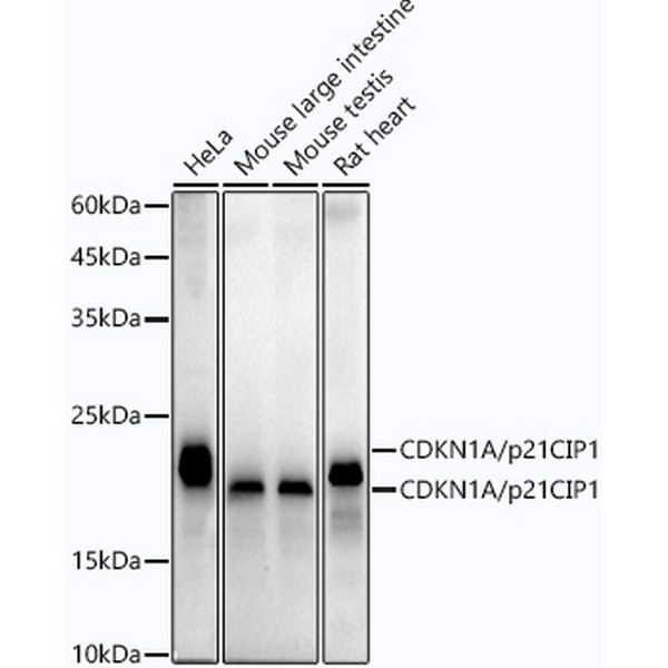 [KO Validated] CDKN1A/p21 Rabbit mAb (A19094) | Abclonal | Ushelf