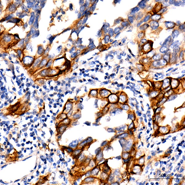PD-L1/CD274 Rabbit mAb (Clone:ARC2478) | Ushelf