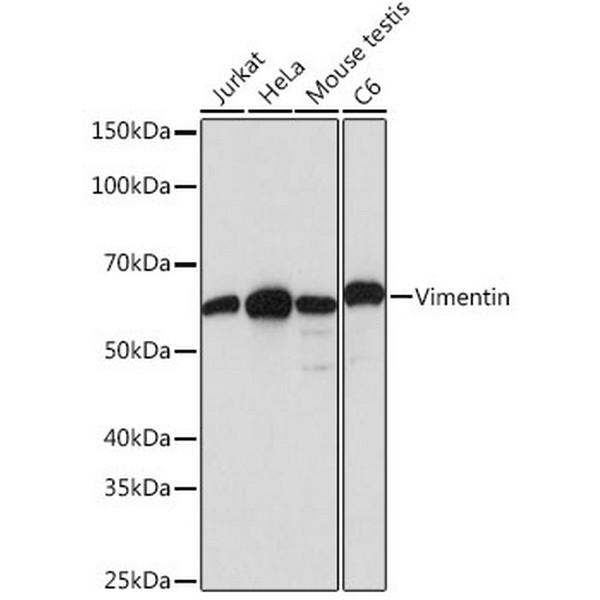 [KO Validated] Vimentin Rabbit mAb (A19607) | Abclonal | Ushelf