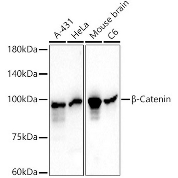 β-Catenin Mouse mAb (A20221) | Abclonal | Ushelf