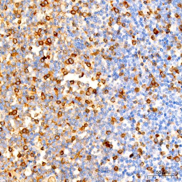 human IgG (Fc) Mouse mAb (A21215) | Abclonal | Ushelf