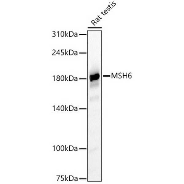 [KO Validated] MSH6 Rabbit mAb (A22652) | Abclonal | Ushelf