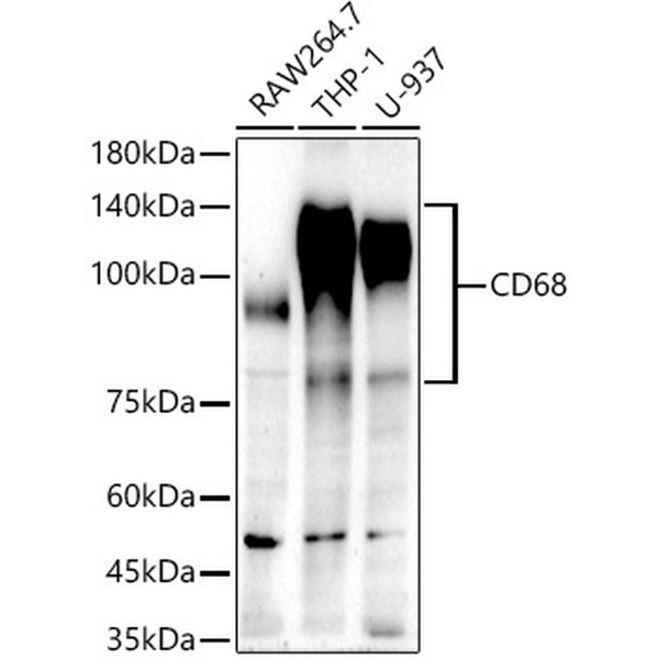 CD68 Rabbit mAb (A23205) | Abclonal | Ushelf