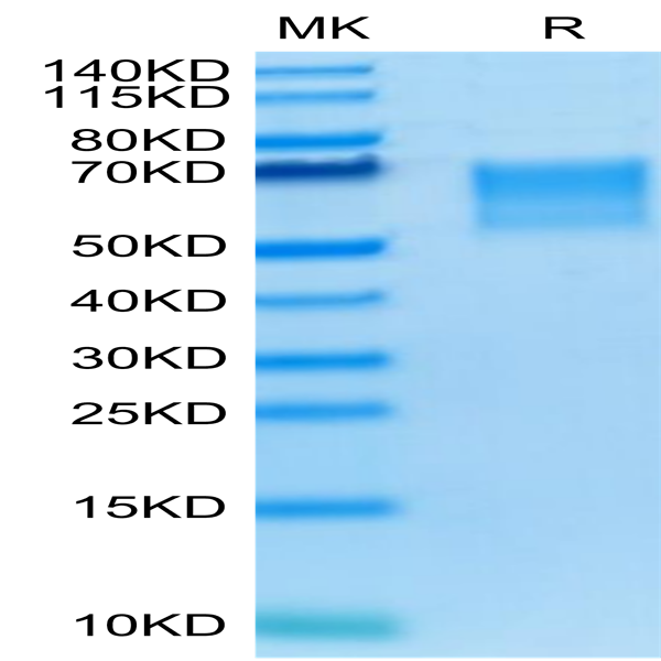 Human TPBG/5T4 Protein (5T4-HM401) | KACTUS Biosystems | Ushelf