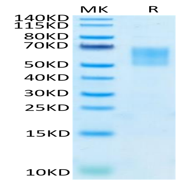 FITC-Labeled Human TPBG/5T4 Protein (5T4-HM401F) | KACTUS Biosystems | Ushelf