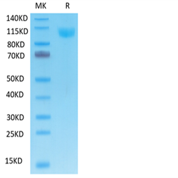 Human ACE2/ACEH Protein (ACE-HM401) | KACTUS Biosystems | Ushelf