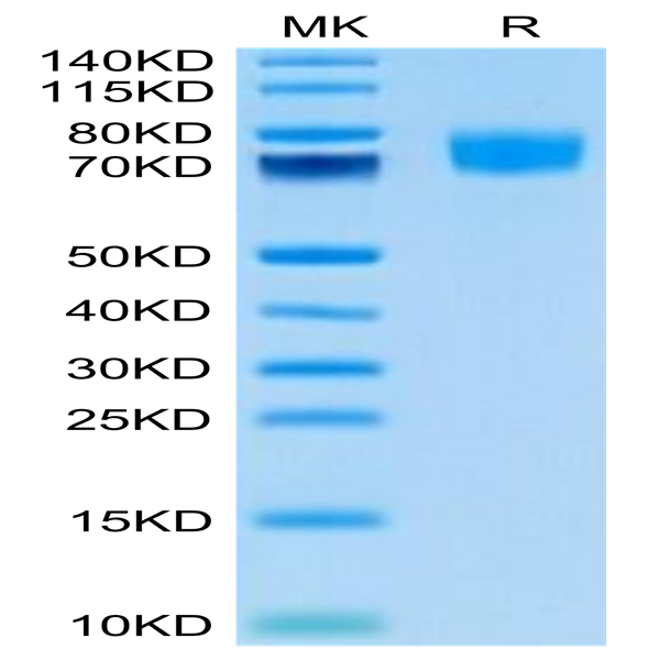 Biotinylated Human ALCAM/CD166 Protein (Primary Amine Labeling) (ALC ...