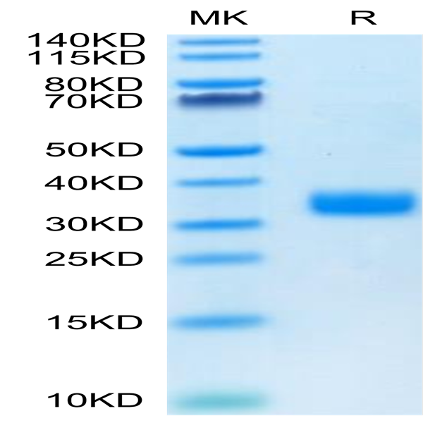 Mouse ANGPTL4/Angiopoietin-like 4 Protein (ANG-MM104) | KACTUS ...