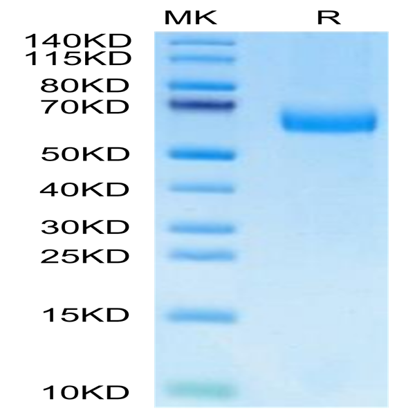 Mouse Alkaline phosphatase (Intestinal type) /ALPI Protein (APE-MM101 ...