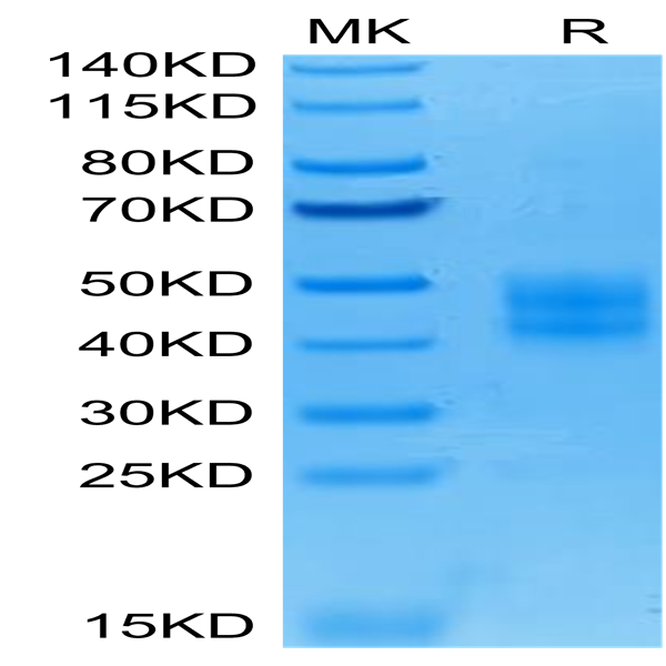 Human B7-H3/CD276 Protein (BH7-HM173) | KACTUS Biosystems | Ushelf