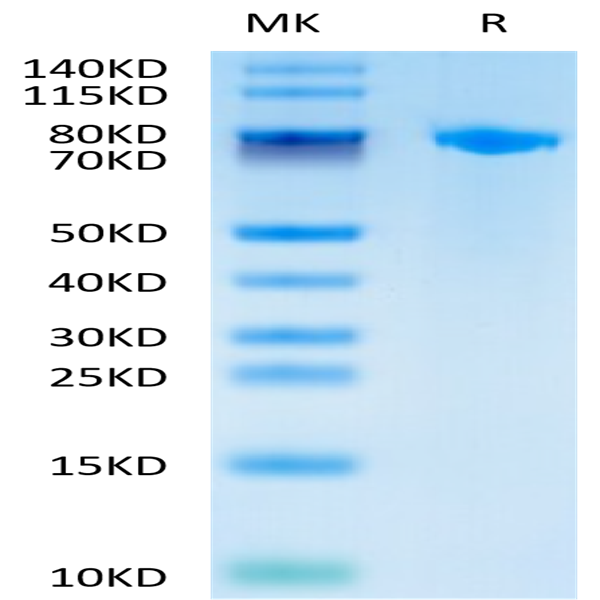 Cynomolgus Coagulation factor XI Protein (FXI-CM101) | KACTUS ...