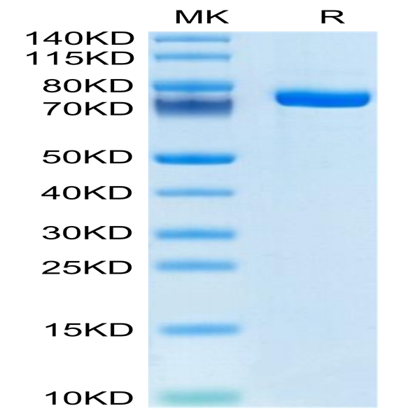Human Factor XI Protein (FXI-HM101) | KACTUS Biosystems | Ushelf