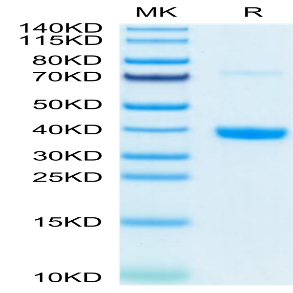 Mouse MFAP4 Protein (MAP-MM104) | KACTUS Biosystems | Ushelf