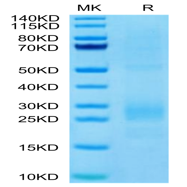 Human MIF Protein (MIF-HM101) | KACTUS Biosystems | Ushelf
