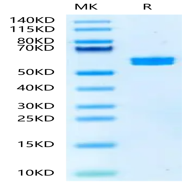 Mouse PKM2 Protein (PKM-MB102) | KACTUS Biosystems | Ushelf