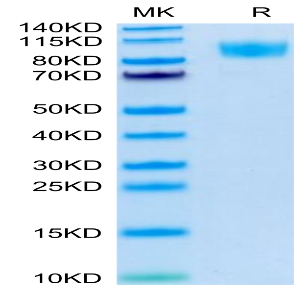 Biotinylated Human CD45/PTPRC Protein (PTP-HM404B) | KACTUS Biosystems ...