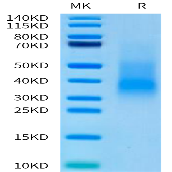 Human RANKL/TNFSF11/CD254 Protein (RKL-HM001) | KACTUS Biosystems | Ushelf