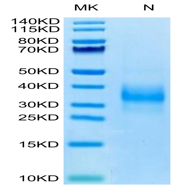 Biotinylated Human SOST/Sclerostin Protein (SOT-HM401B) | KACTUS ...