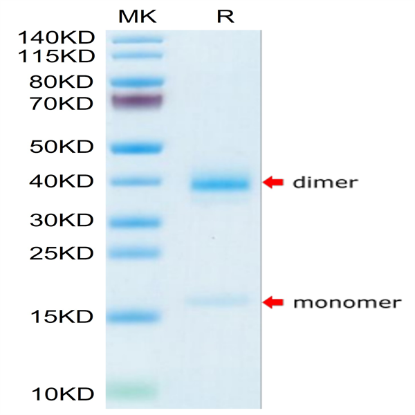 Human Transthyretin/Prealbumin Protein (TSR-HM101) | KACTUS Biosystems ...