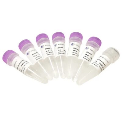 Ribo-off rRNA Depletion Kit (Human/Mouse/Rat) (N406) | Vazyme | Ushelf